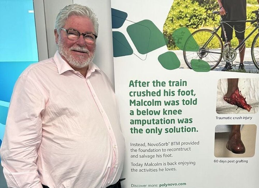 PolyNovo technology critical in Beta Cell diabetes discovery