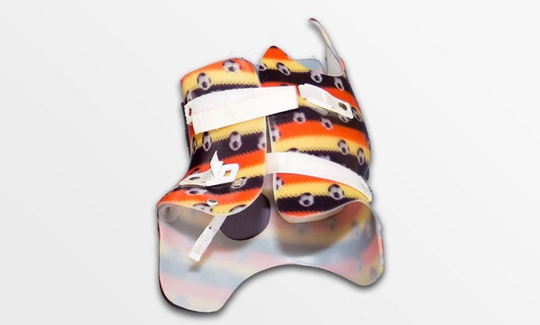 Custom Orthotics Mississauga | Orthobility Bracing