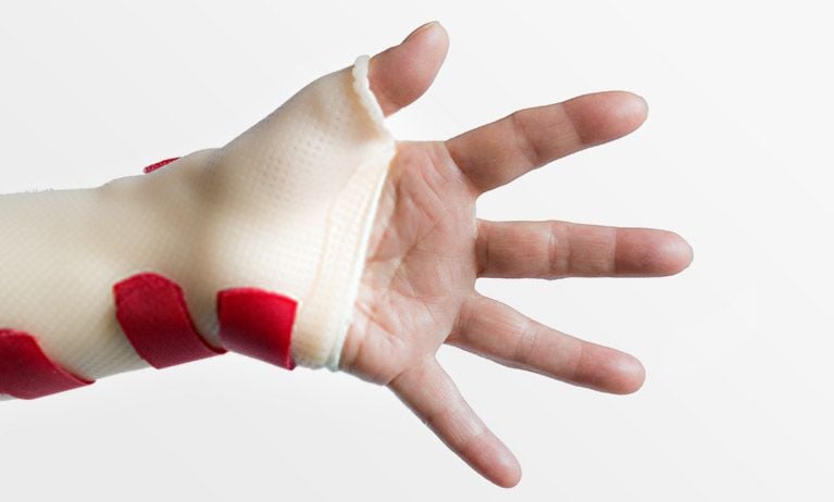 Custom Orthotics Mississauga | Orthobility Bracing